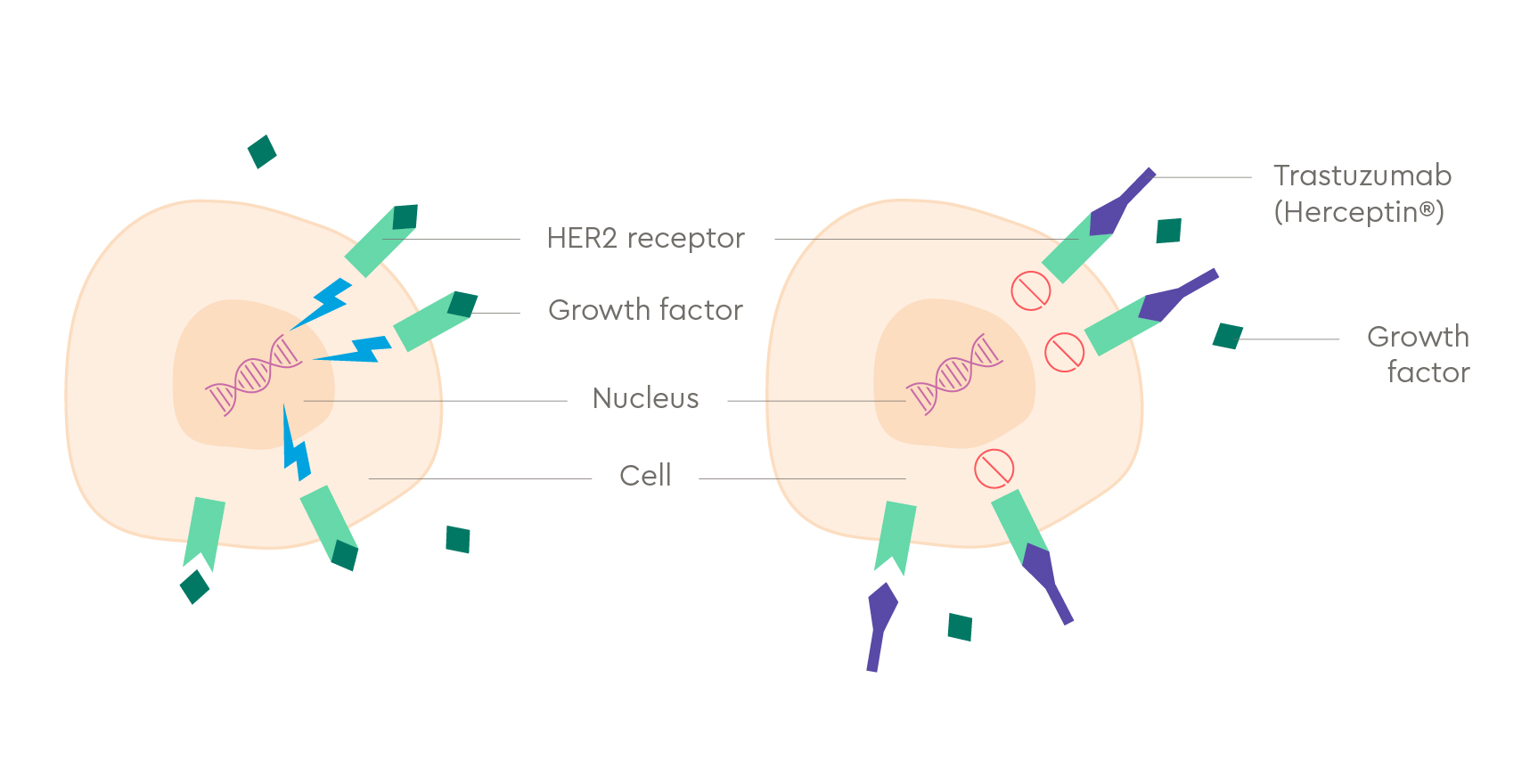 Breast illustrations | GenesisCare UK
